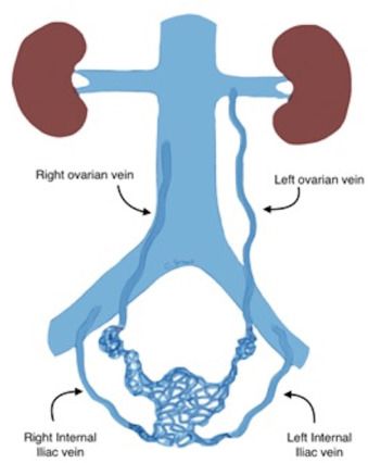 Related Conditions – AVCS